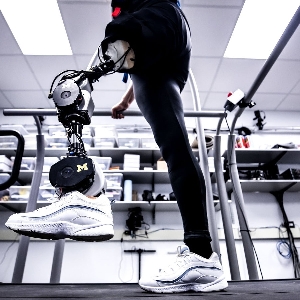 Open Source Leg: Pengembangan Penelitan Kaki Bionik - blackxperience.com